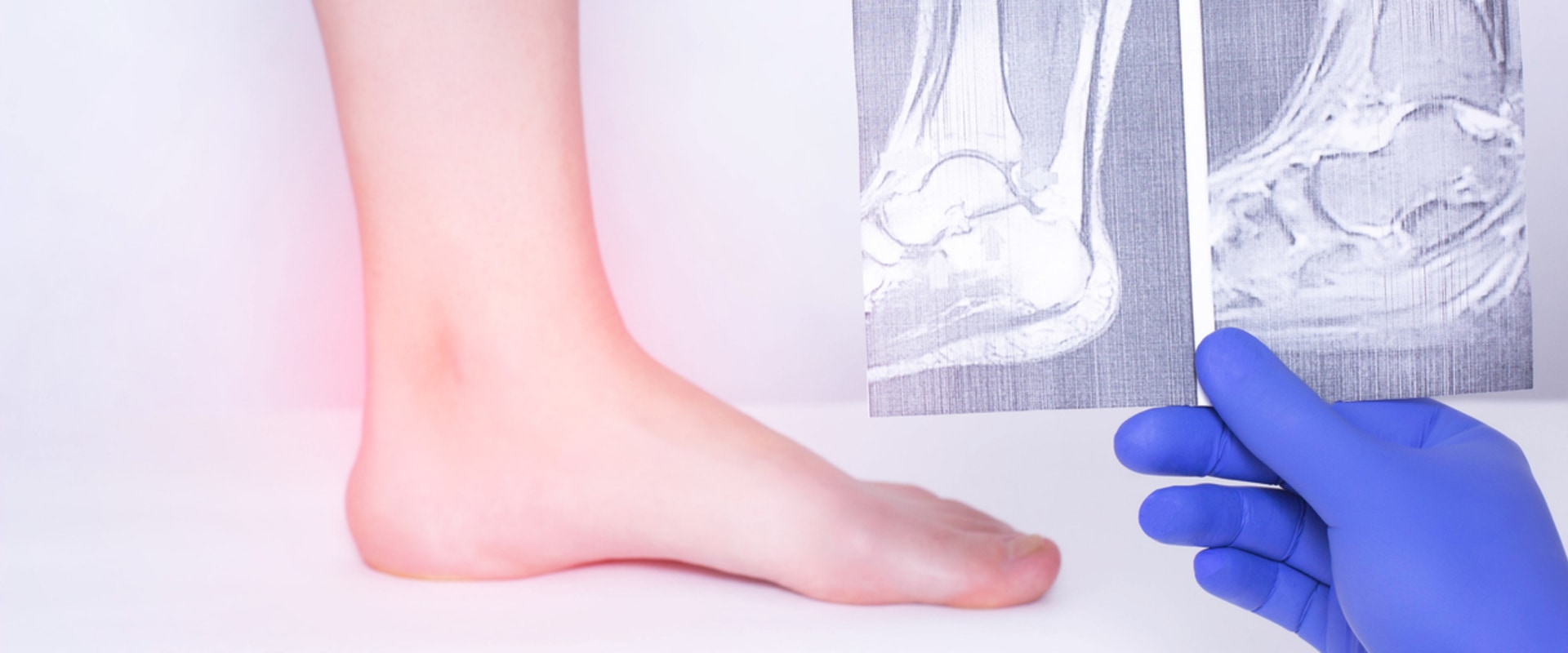 How to Strengthen Weak Ankles and Prevent Injuries: Tips and Exercises ...