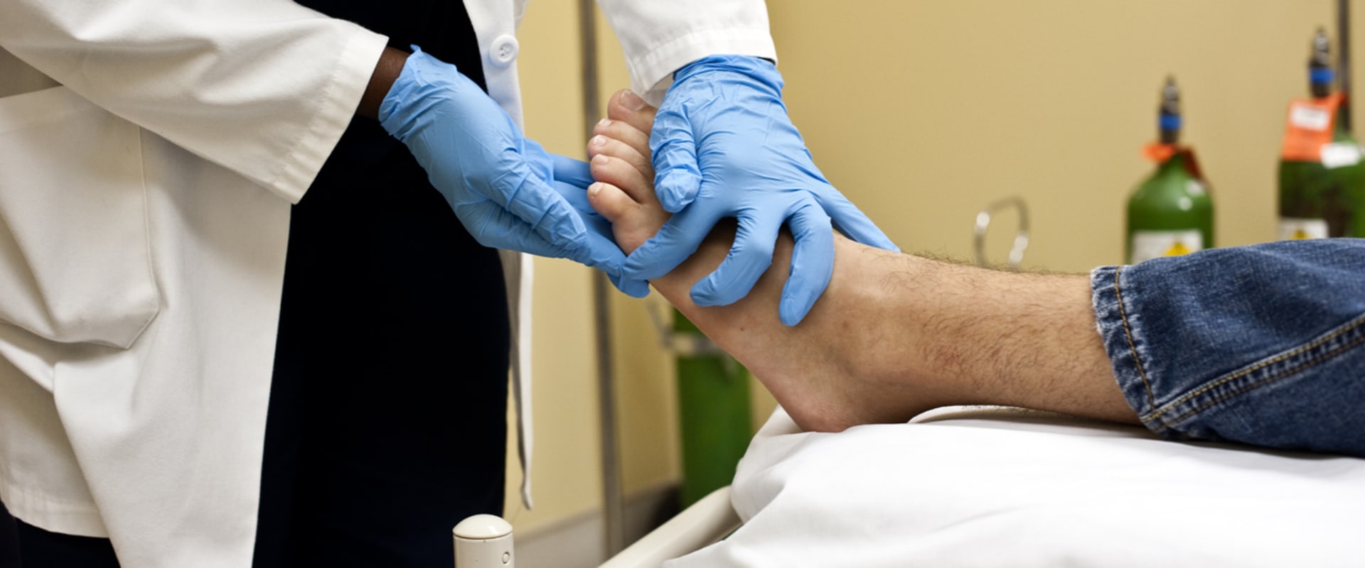 Fix Thick Toenails Fast: Ram's Horn Toenail Treatment Options