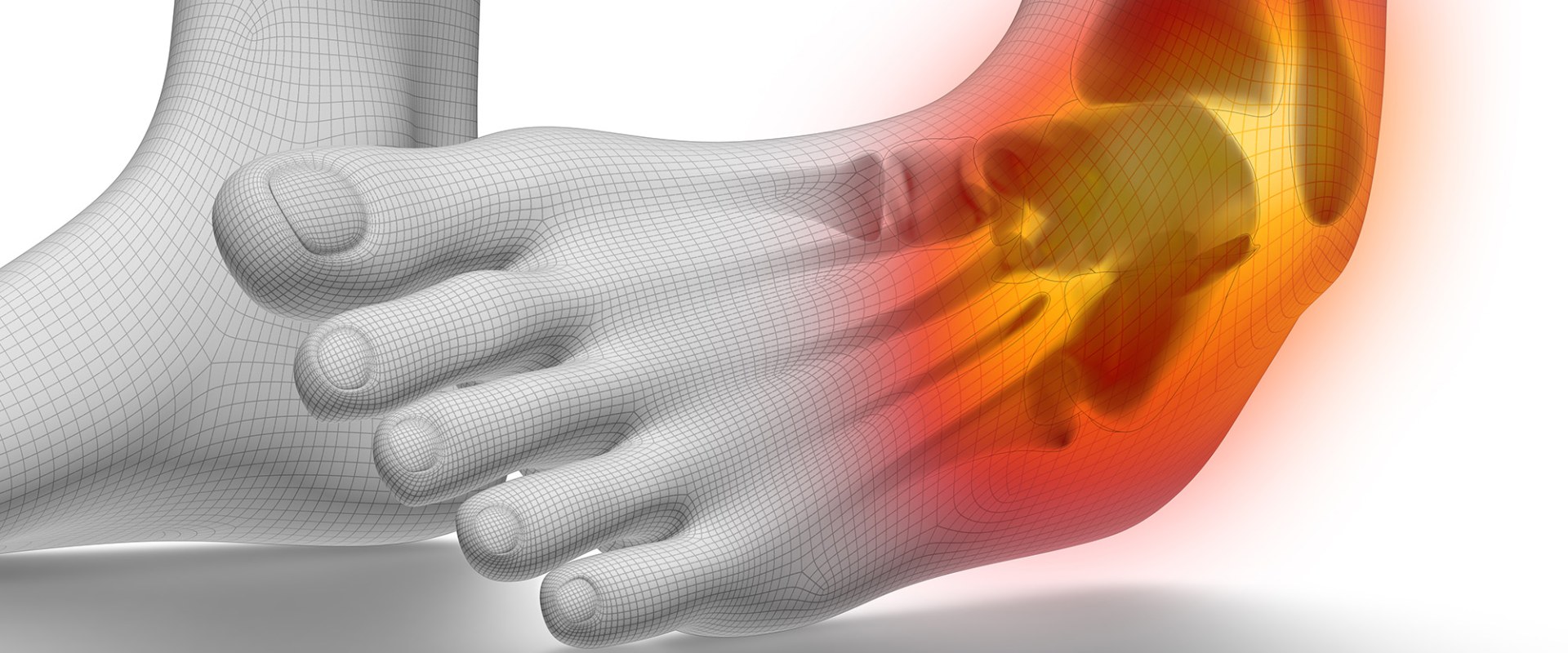 Ankle Sprains: Understanding the Most Prone Side to Injury